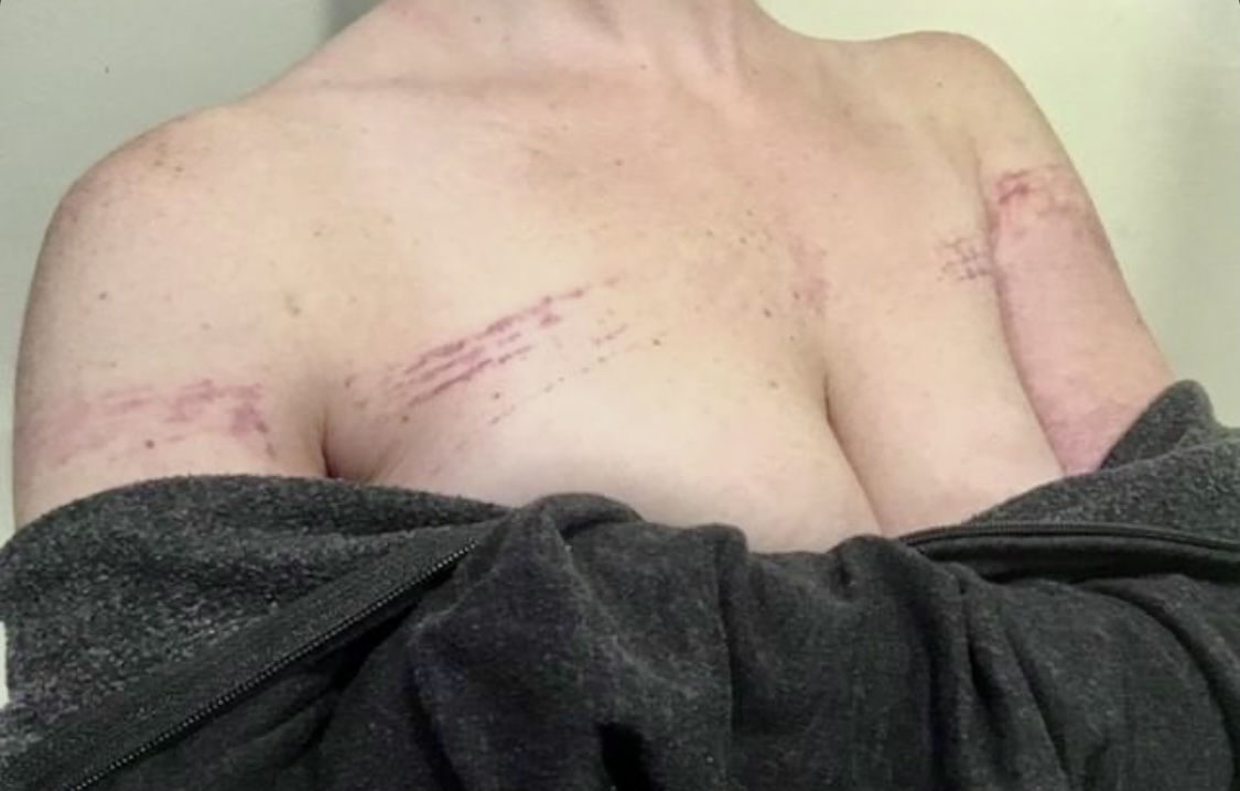 Prevention & Response – Rope Study